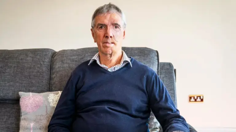 Hombre pierde la mitad del rostro y logra reconstrucción con prótesis ...